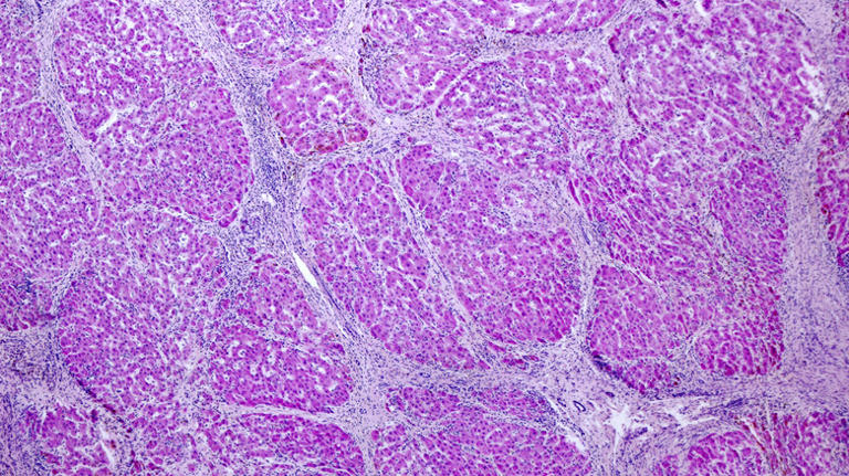 The Vital Human Organ That Can Miraculously Regenerate