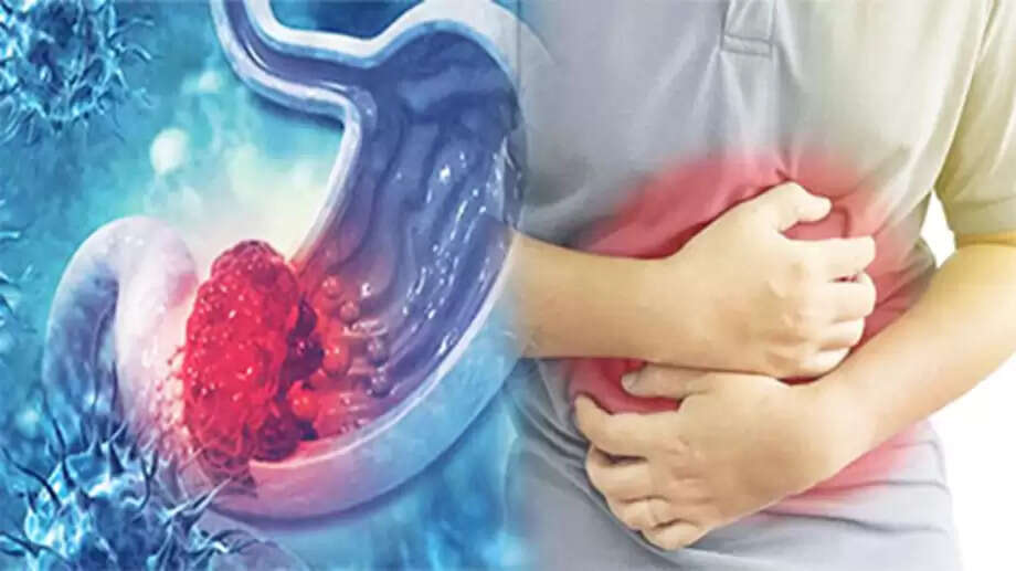 Recognizing the Early Signs of Stomach Cancer