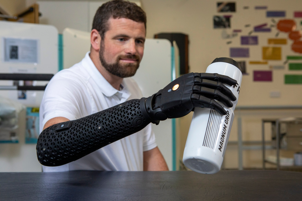 Amputee farmer receives new super advanced bionic arm
