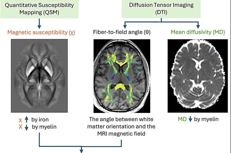 Schizophrenia is linked to iron and myelin deficits in the brain ...