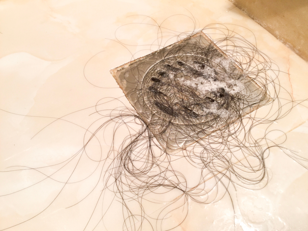 The real reasons your hair is falling out – and how to fix it