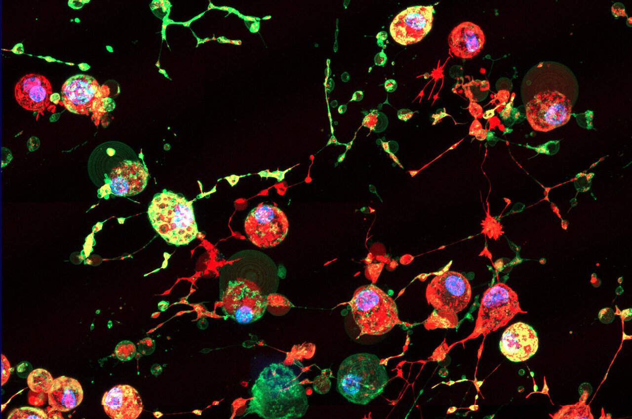'Footprint of death' gives new clues to cell life and disease spread