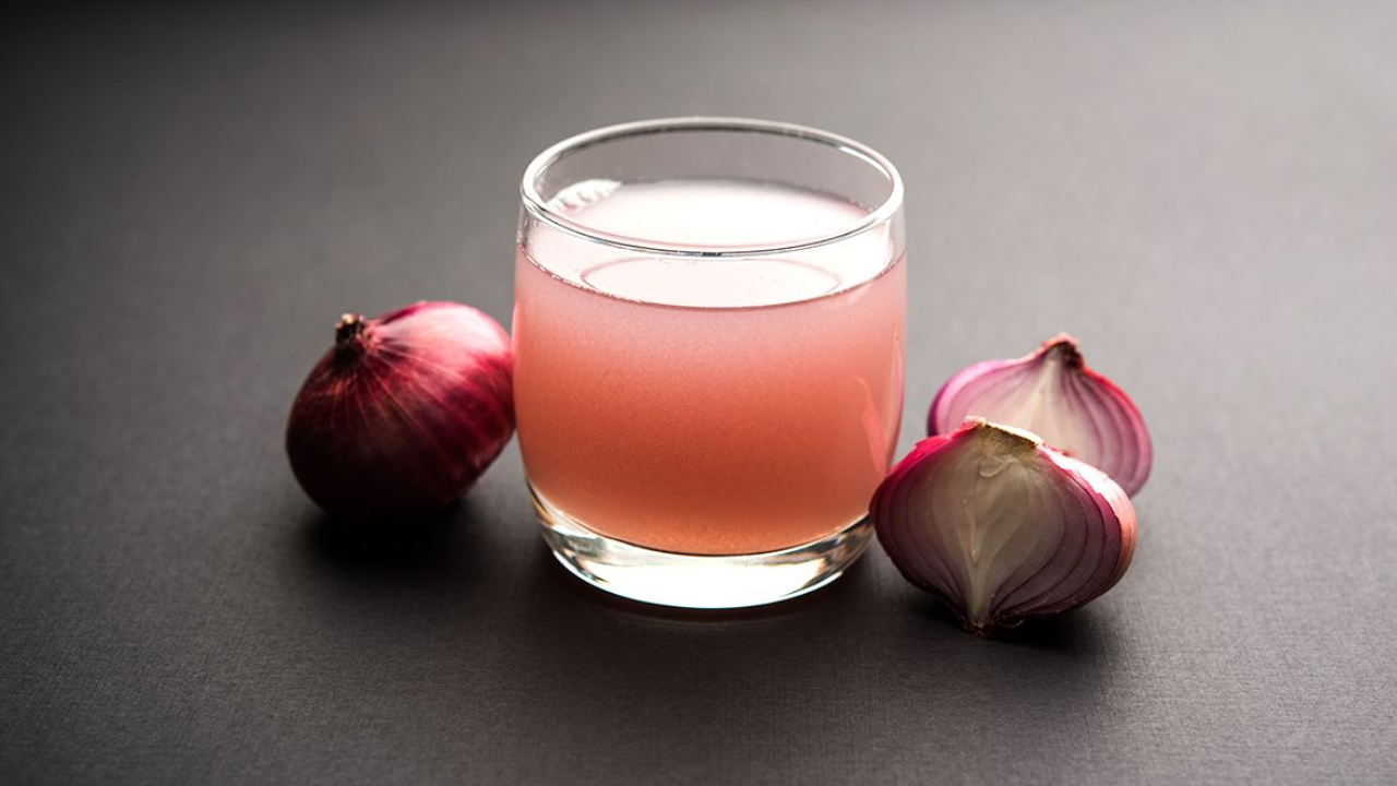 Onion juice or garlic for hair growth: Which is a better home remedy ...