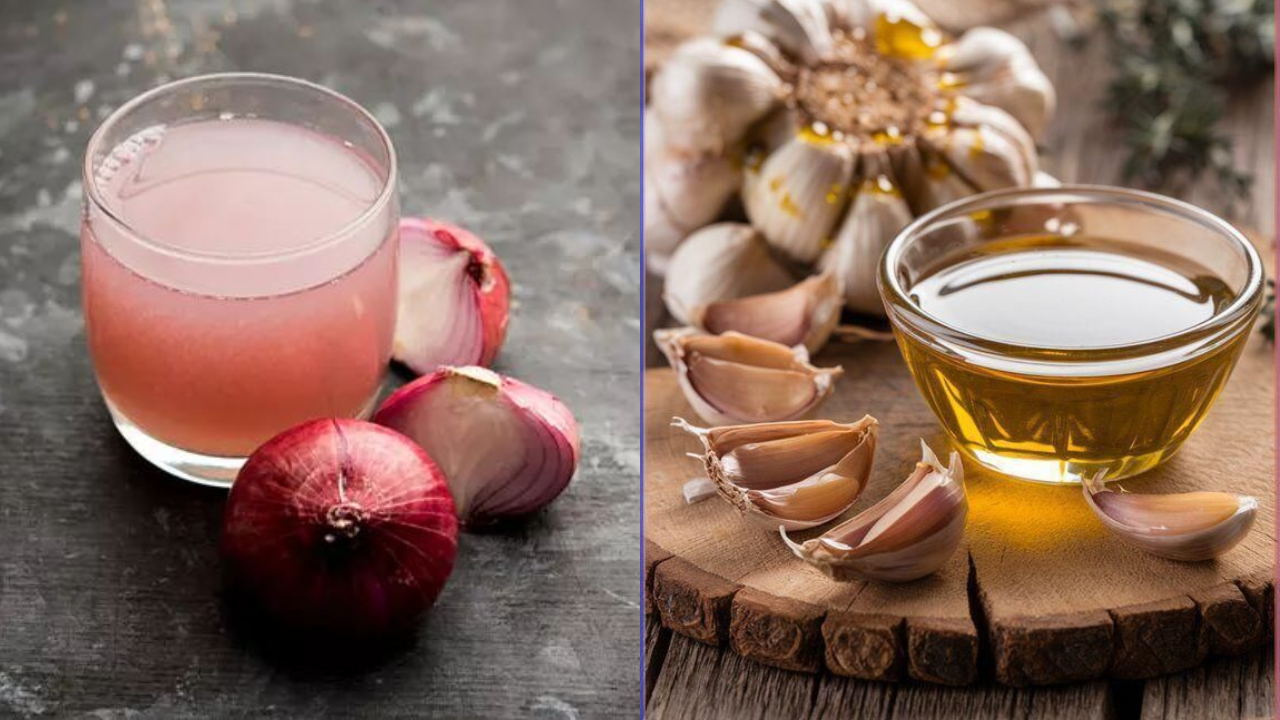 Onion juice or garlic for hair growth: Which is a better home remedy ...
