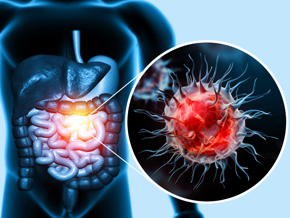 Top US doctor urges everyone over 30 to take this test: It could stop ...