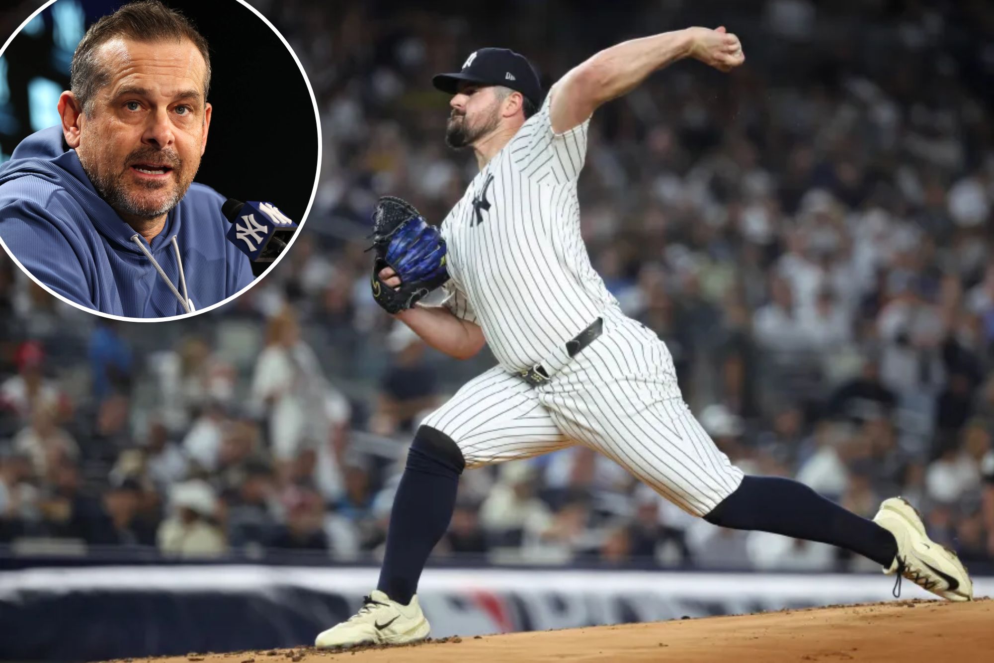 Yankees’ Carlos Rodon undergoes surgery that will delay his 2026 start