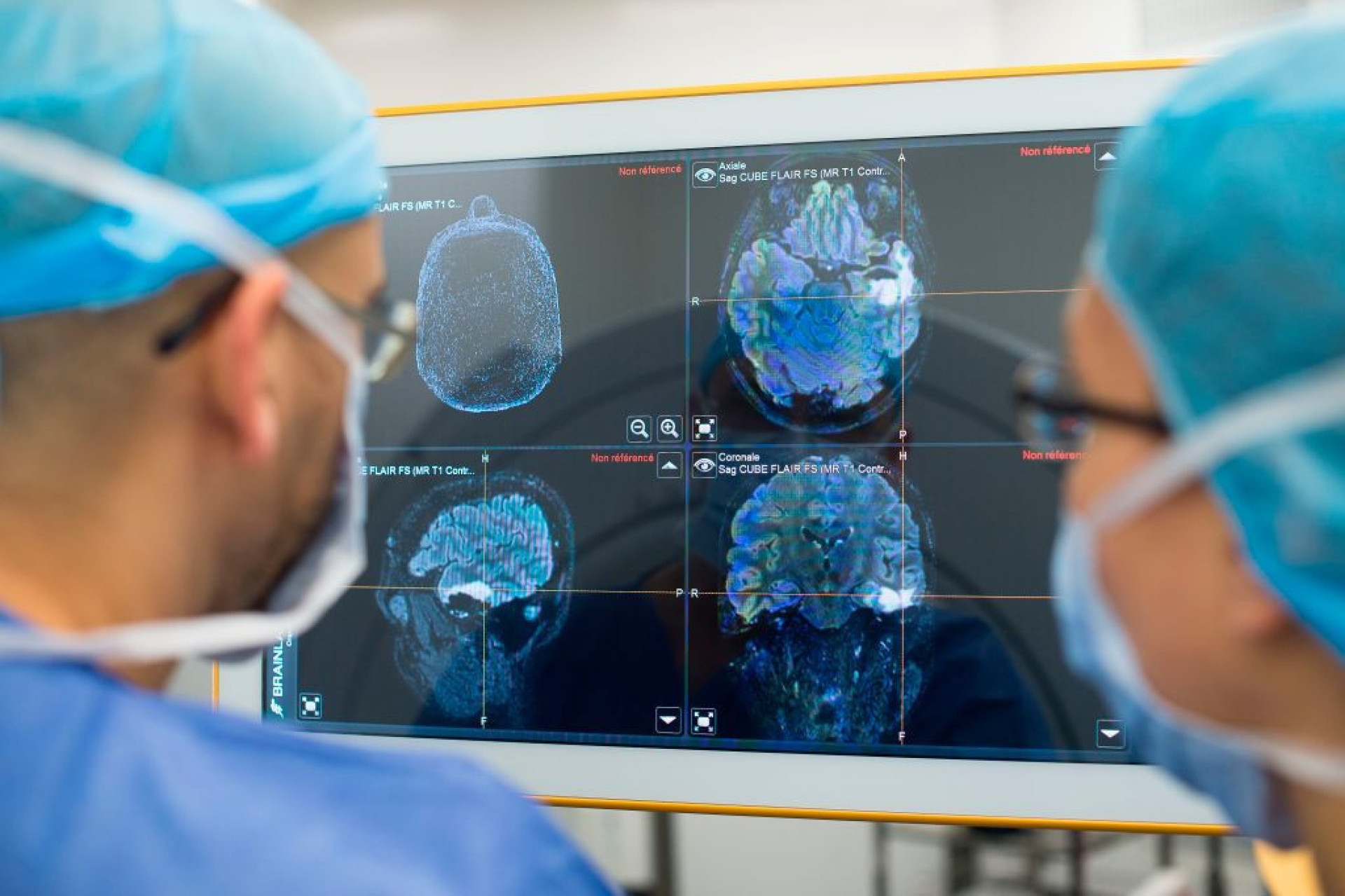 Revolutionary AI tool helps surgeons spot invisible cancer