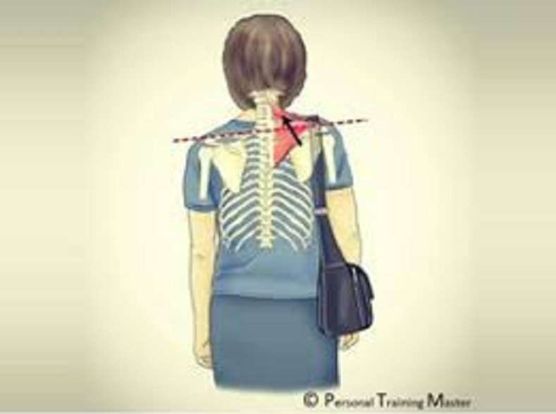 The habit of carrying a bag on one shoulder can lead to arthritis, so ...