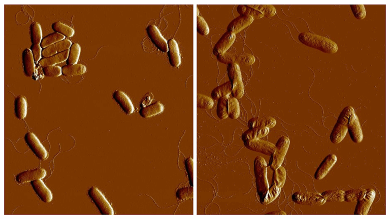 Molekyl hjälper bakterier motstå vårt immunförsvar och antibiotika