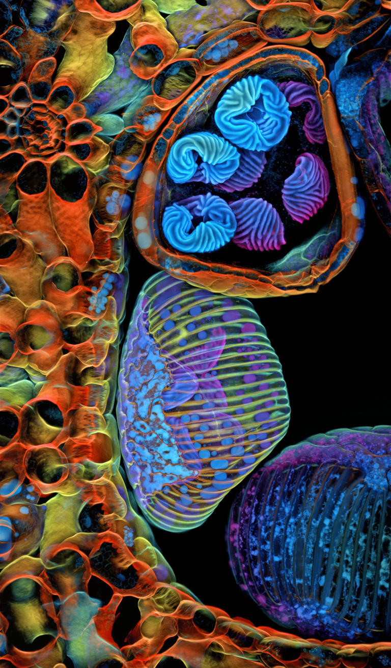These Beautiful Microscope Photos Capture Tiny Pests, Spores, Sensory ...