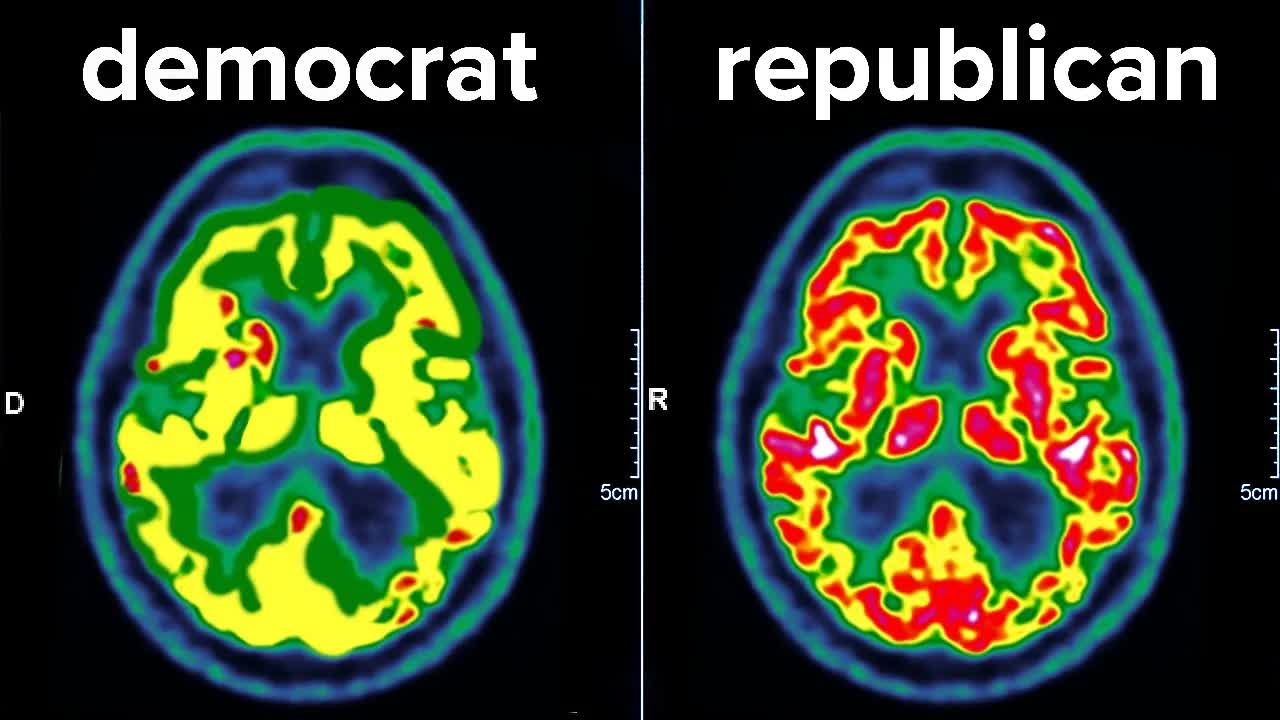 I scanned a Democrat & Republican's brains