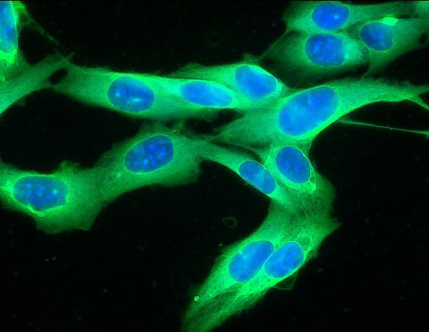 CRATERs identified as key sites for T cell-mediated tumor destruction