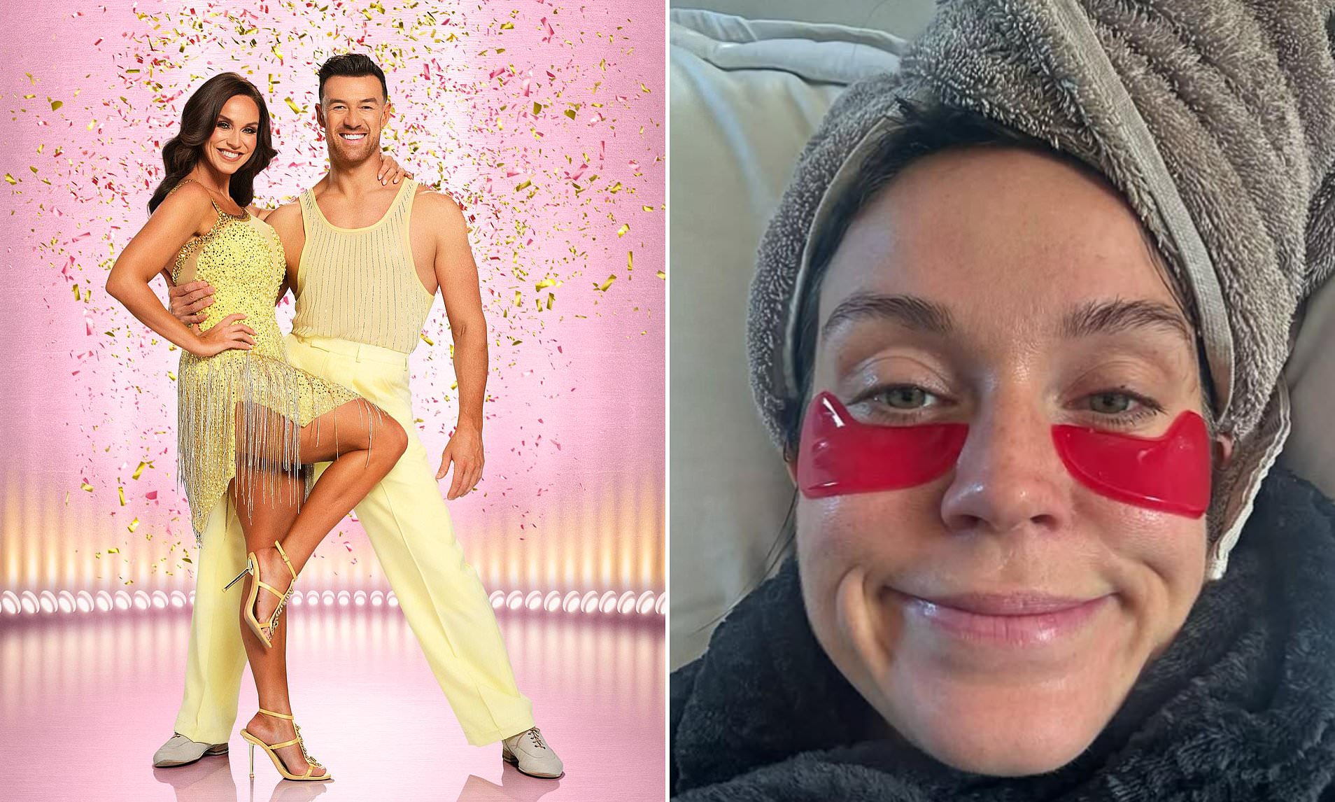 Vicky Pattison's skin specialist shares how she manages the Strictly ...