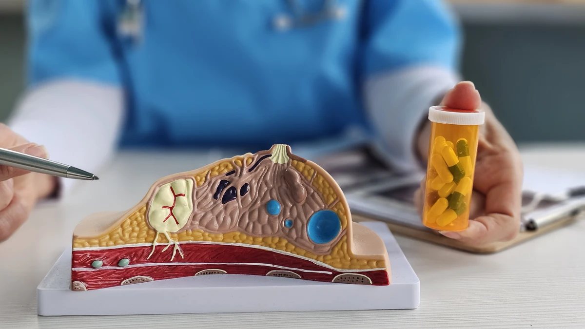 El tratamiento potencialmente curativo para el cáncer luminal