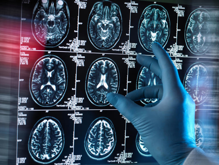 Researchers Have Discovered 2 New Dementia Risk Factors. Here's What ...