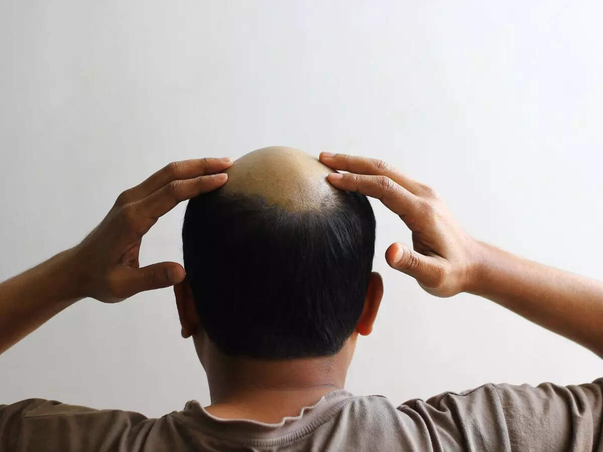 5 tips to grow hair faster in middle age