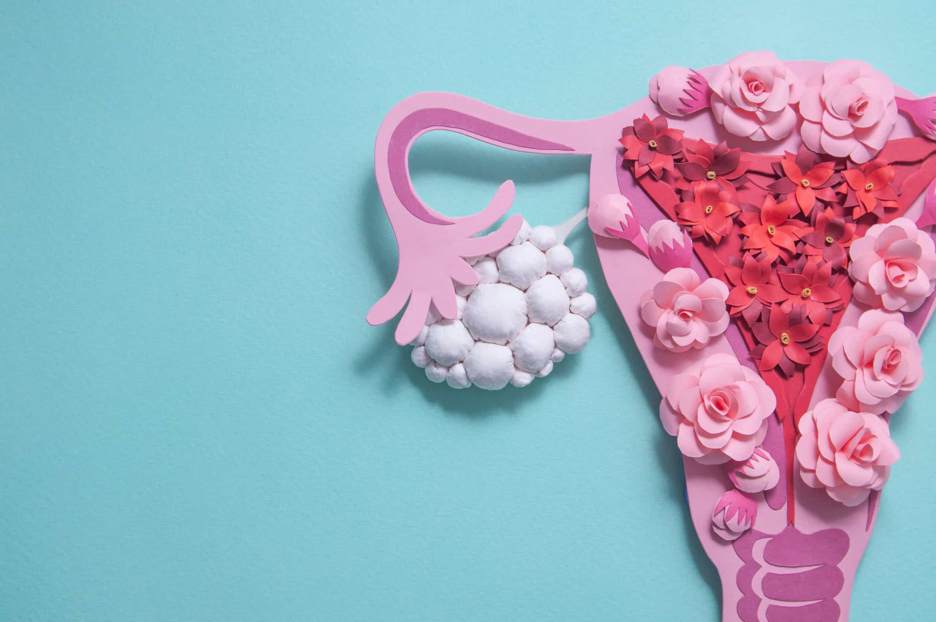 PCOS is now called PMOS, but what does it mean?