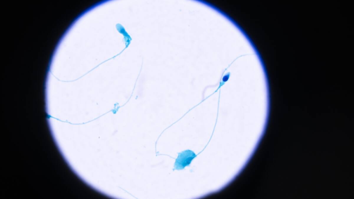 Biologie: Forscher entschlüsseln Verbindung zwischen Eizelle und Spermium