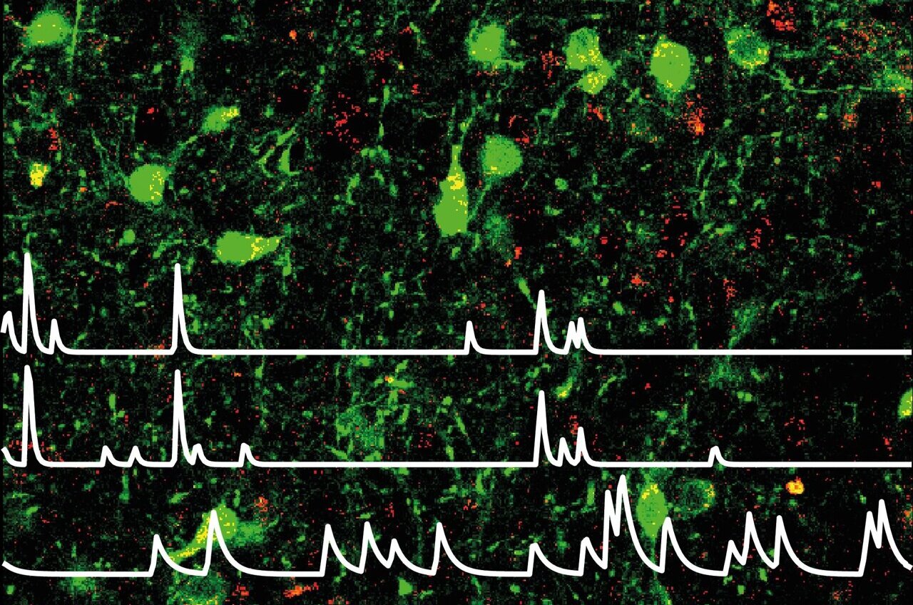 Eat, explore, rest: Leptin-sensing brain circuit helps overcome anxiety ...