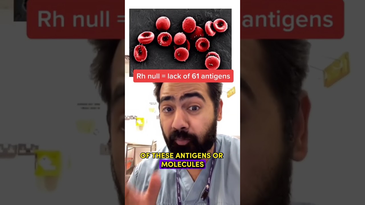 Doctor explains rarest blood type in the world