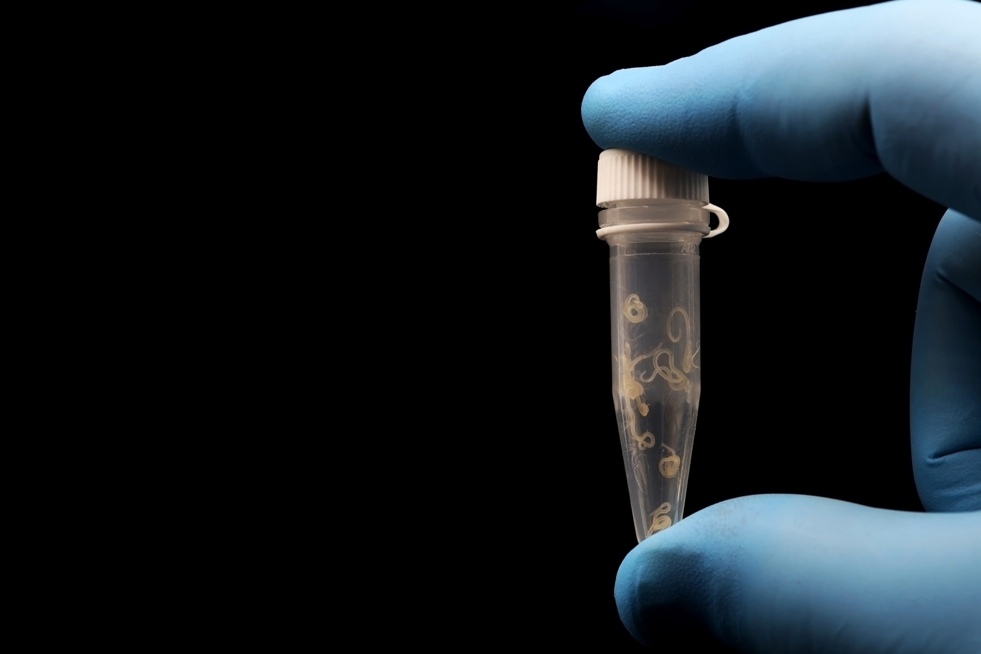 The 30 most terrifying parasitic diseases in the world