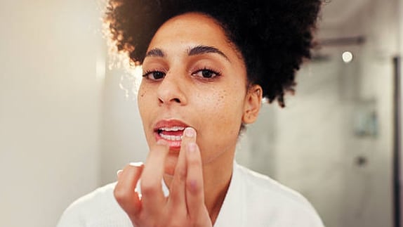 ¿Por Qué El Uso Frecuente De Bálsamo Labial Podría Dañar Tus Labios?