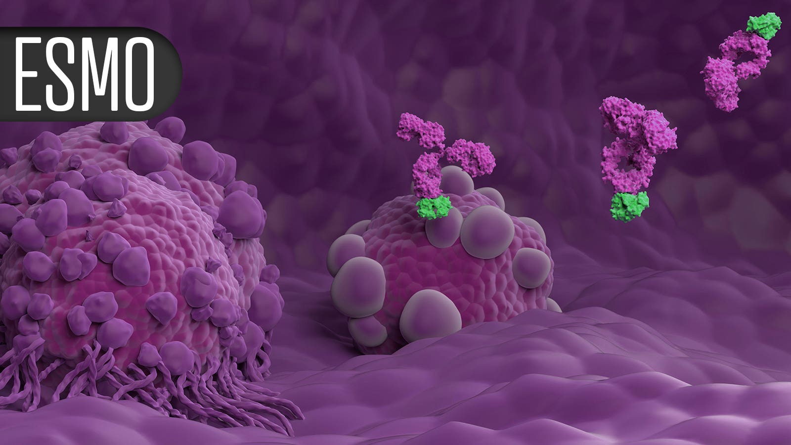 De-Escalating Bone-Modifying Therapy Safe, Effective in Metastatic ...