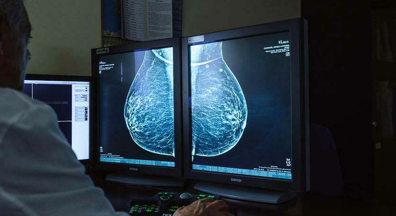 La rigidità dei tessuti influisce sulla crescita dei tumori: la ...
