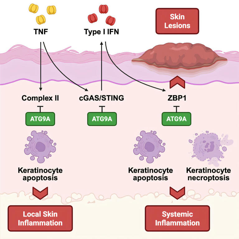 Scientists discover how cells protect the skin from inflammatory ...