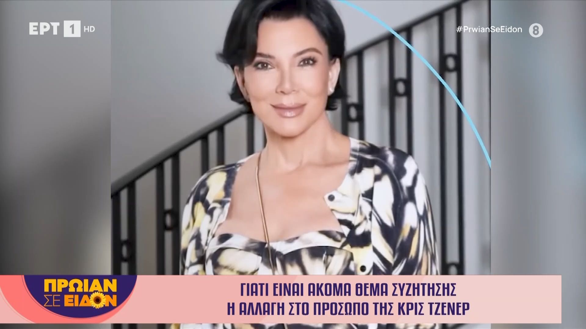 Γιατί είναι ακόμα θέμα συζήτησης η αλλαγή στο πρόσωπο της Κρις Τζένερ