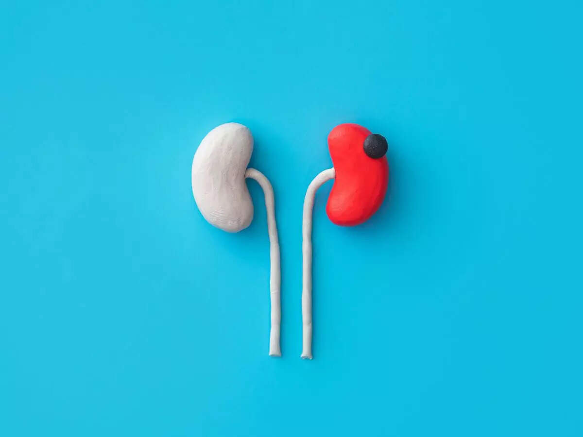 Kidney cancer: 4 foods you must avoid to lower the risk