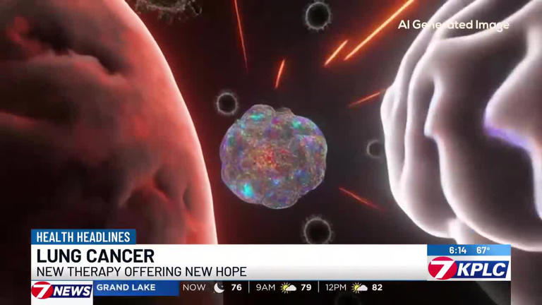 Targeted therapy improving lung cancer patient outcomes