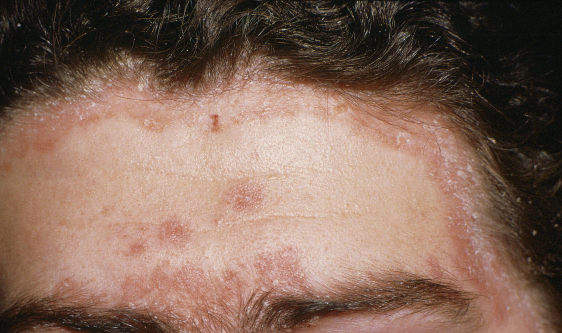 The most common skin conditions, and their cures