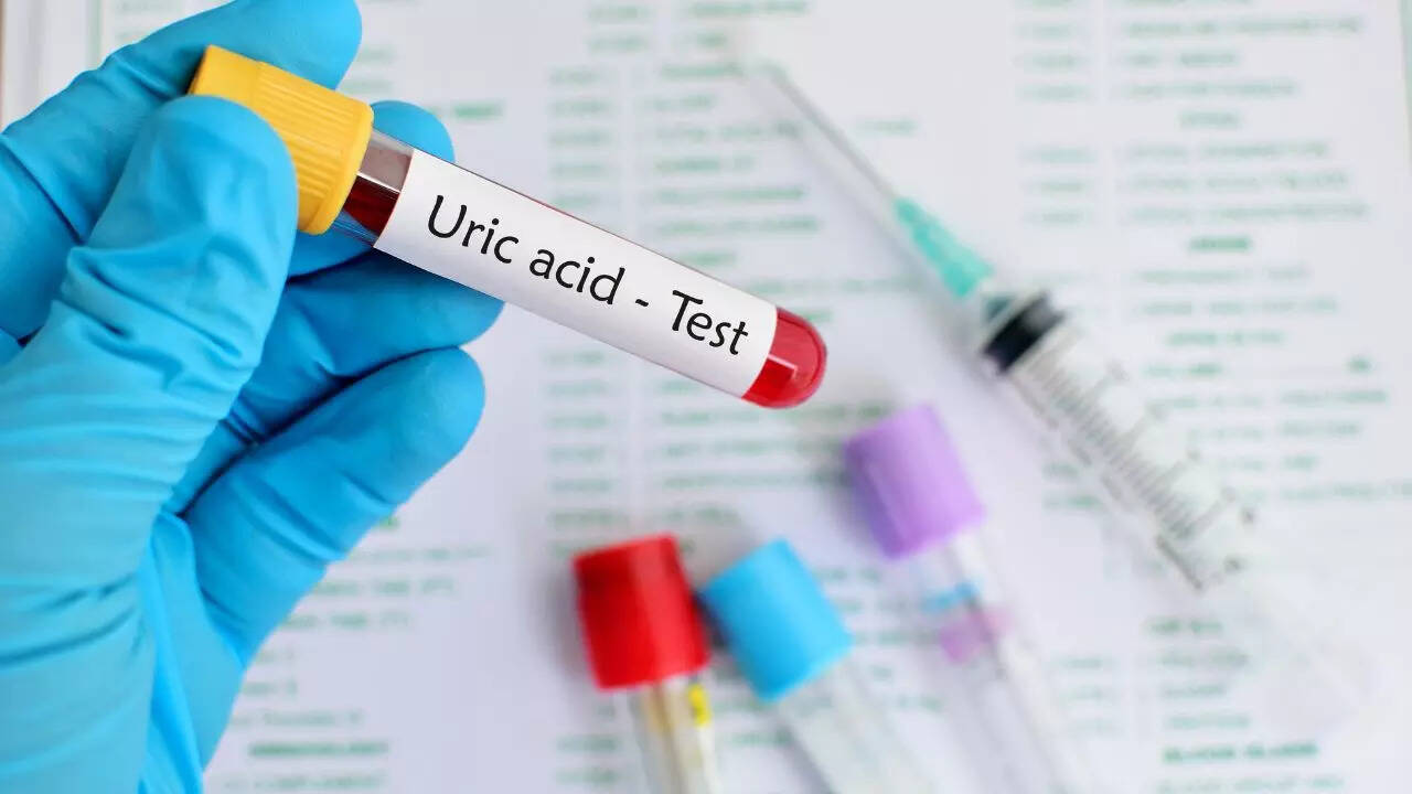 High uric acid and kidney stones: 5 warning signs you shouldn't ignore