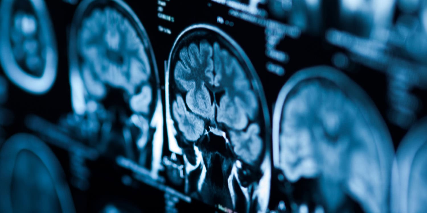 The good news about brain aging: better sleep can make a difference