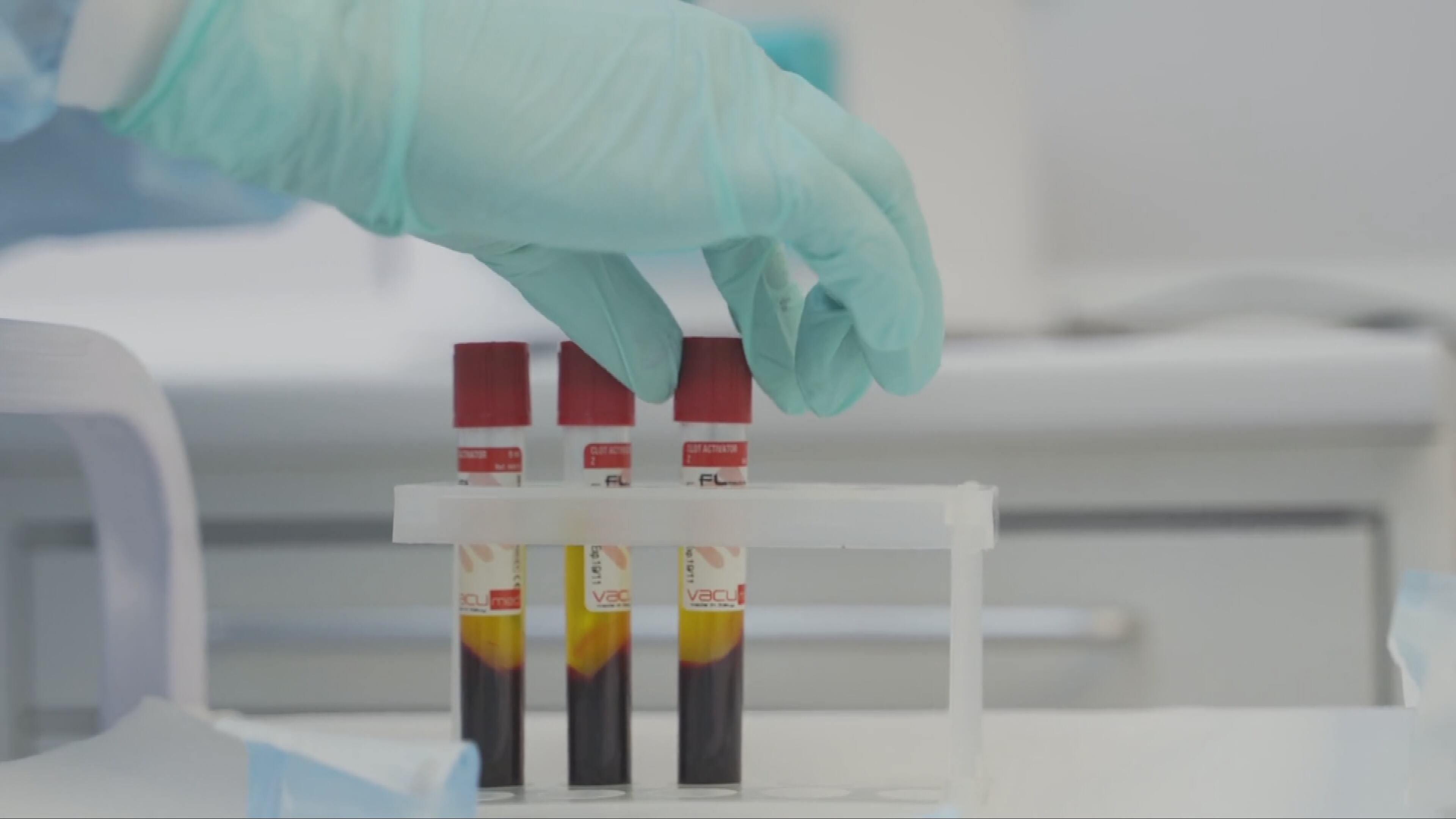 Breakthrough blood test could spot multiple cancers before symptoms appear
