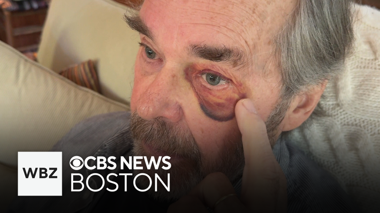 Cape Cod man attacked after “No Kings” protest