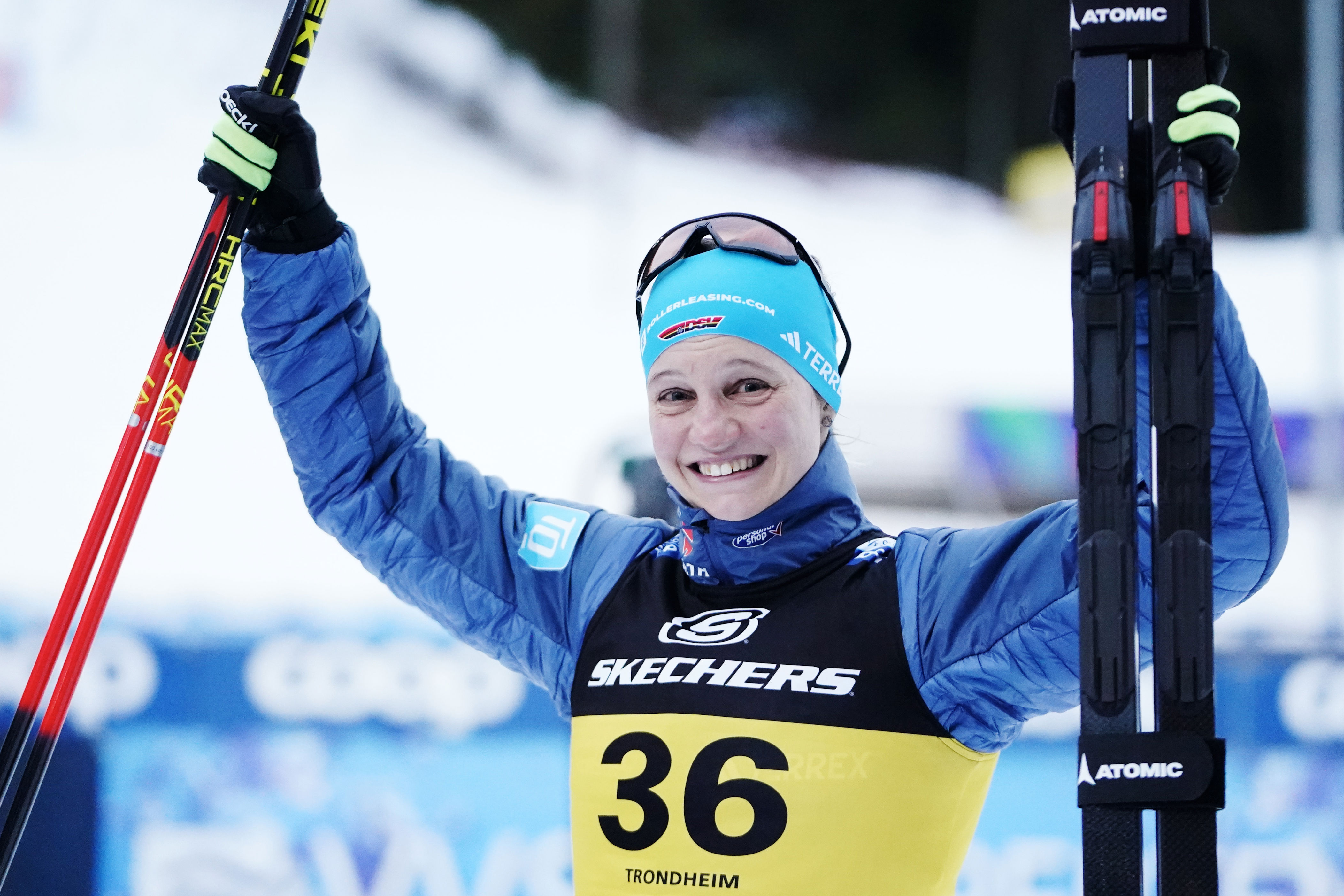 Bjørgen stusser over dopingsak: – Rart at det ikke går raskere