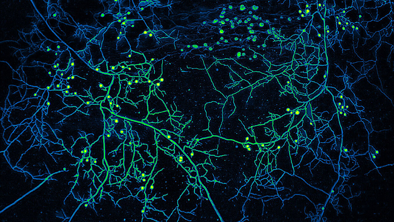 How plant-fungi friendships may change in the face of warming soil and ...