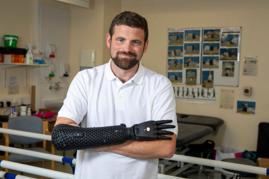 Amputee farmer receives new super advanced bionic arm