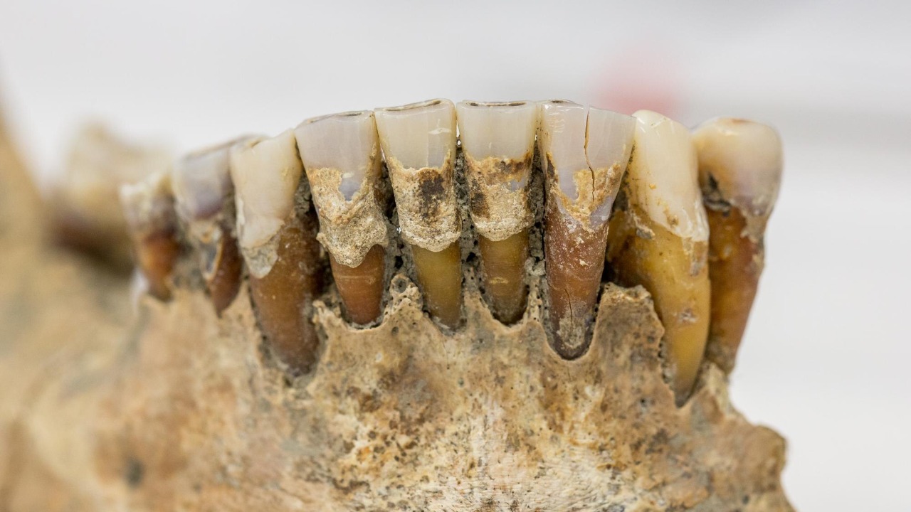 Ancient tooth marks may not be from toothpicks after all