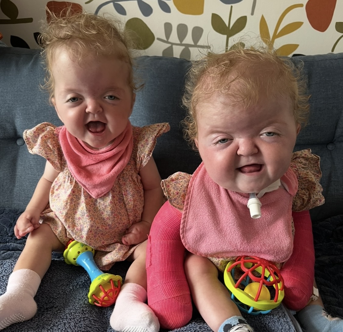 Online auction aims to make big difference for disabled Arundel twin babies