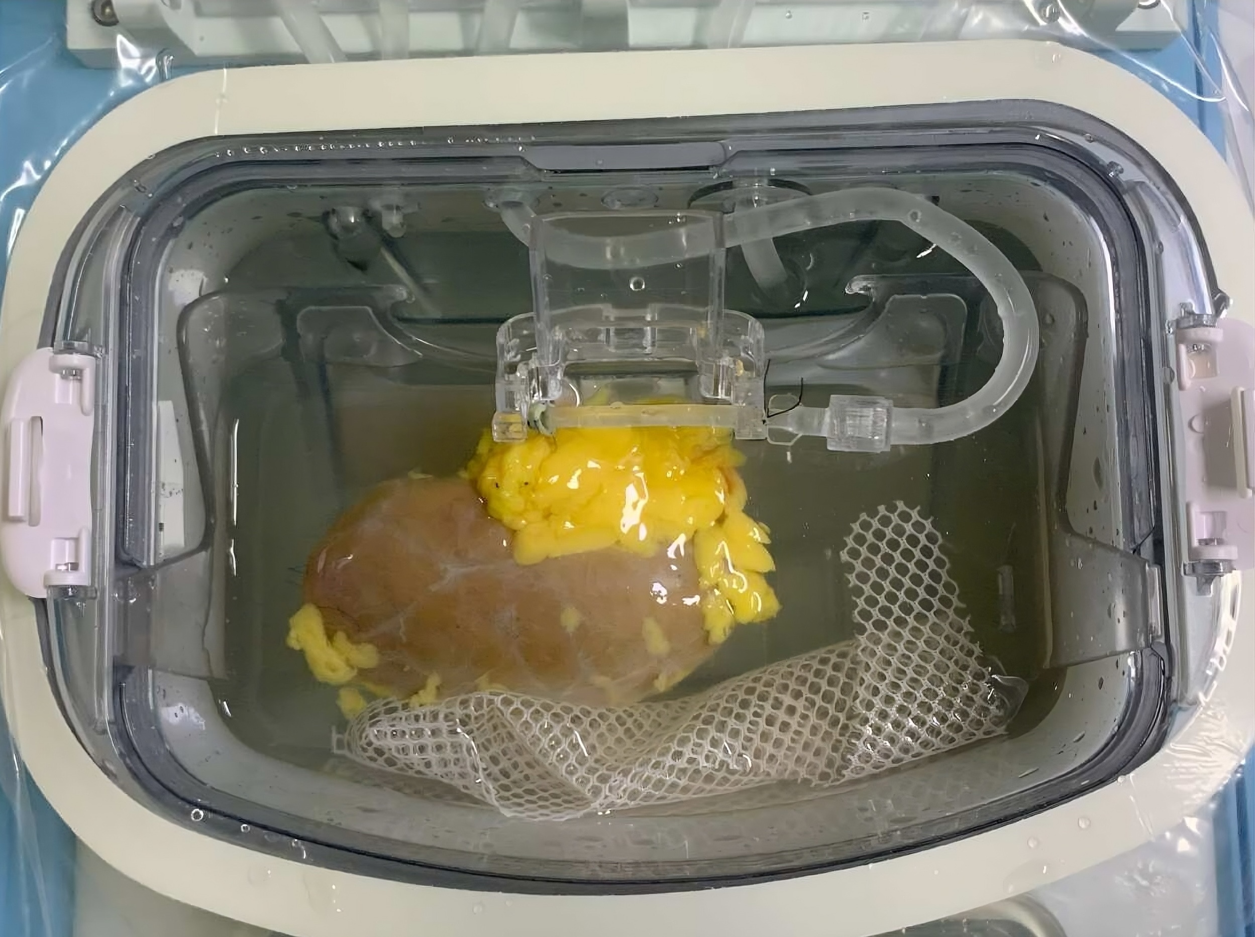 Scientists Converted a Kidney’s Blood Type, Then Implanted It Into a ...