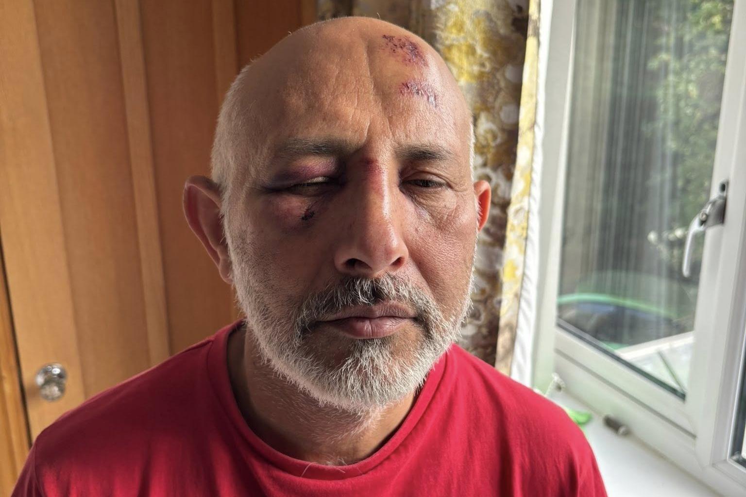 Grandad who 'wouldn't hurt a fly' beaten by young yobs with ...