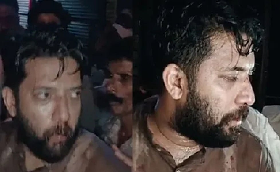 MP Shafi Parambil, Congress leaders injured in police lathi-charge in ...