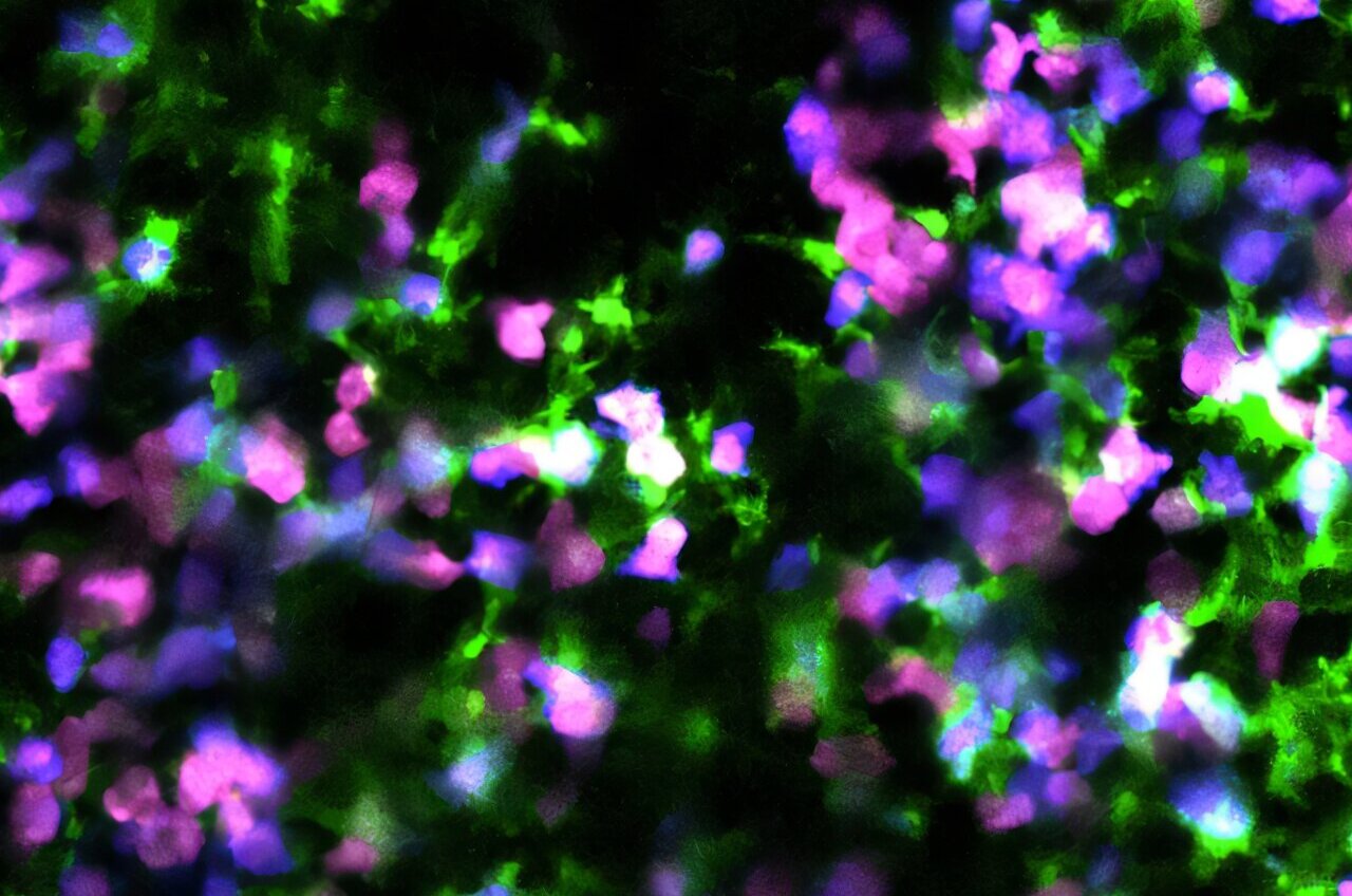 Blood cancer: Scientists reprogram cancer cell death to trigger immune ...