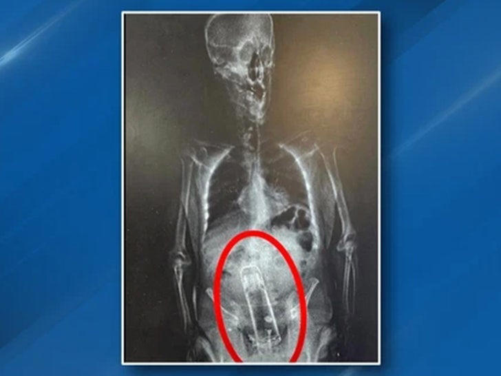 Florida Man Caught With Thermos Up His Rectum, Arrest X-Ray Shows