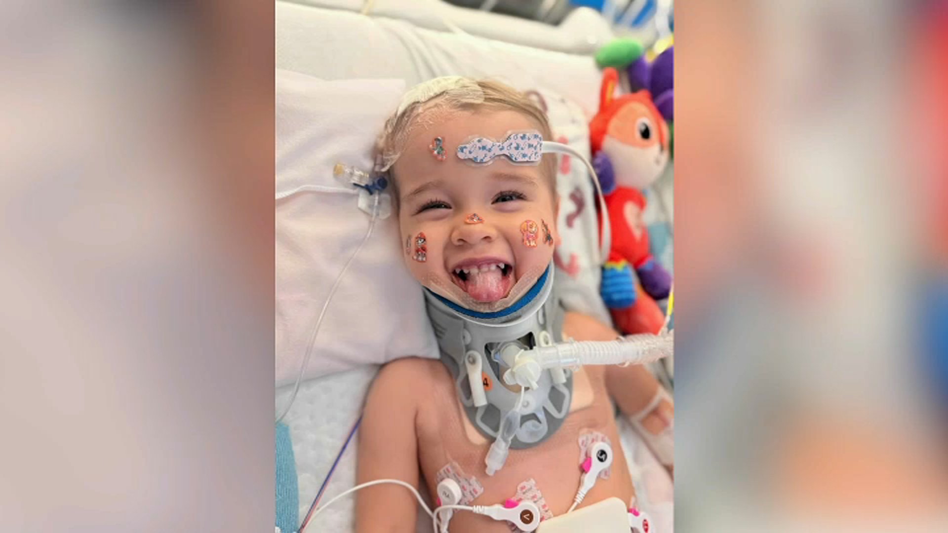 ‘Miracle' 2-year-old defies the odds after severe spinal cord injury