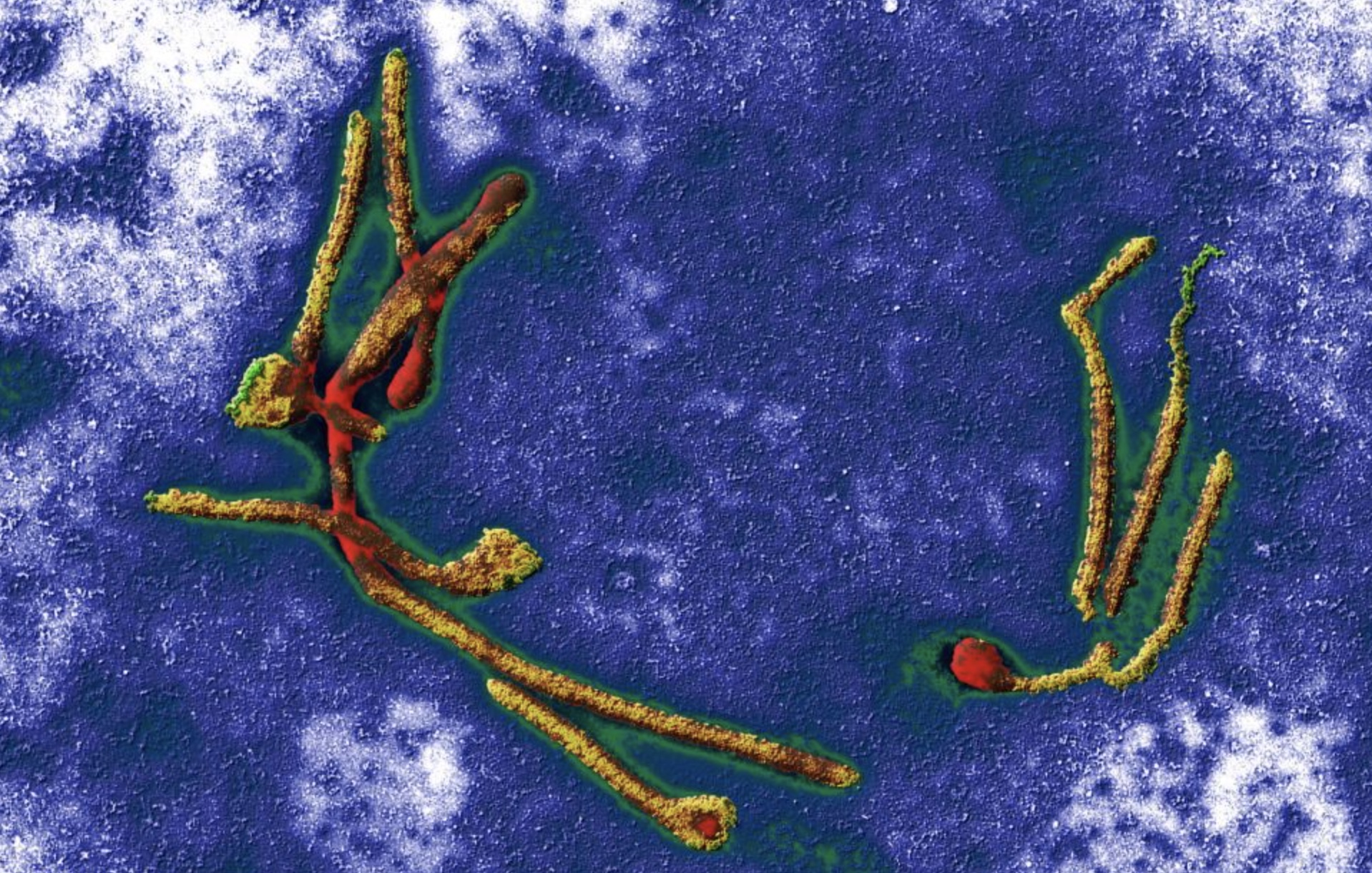 Tiny Viruses Looking Big and Scary Under a Microscope