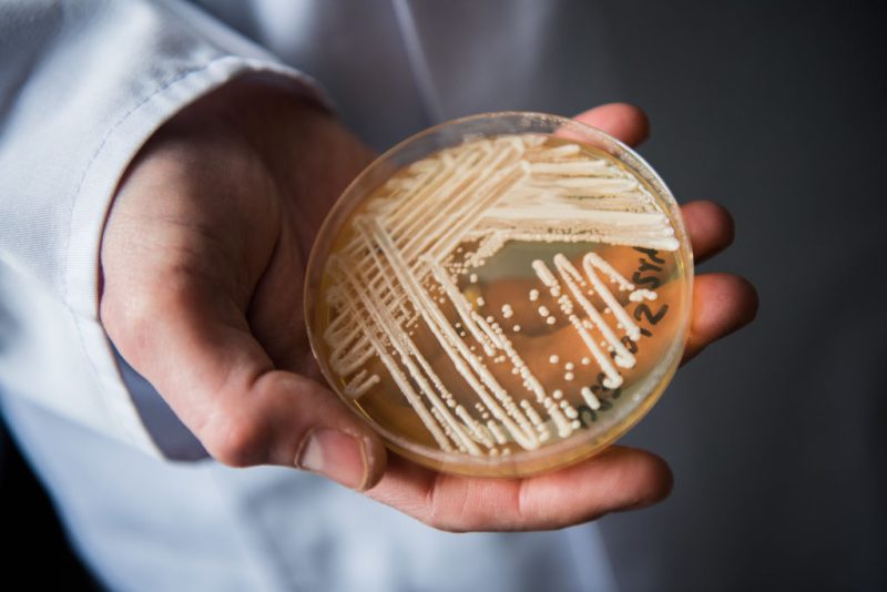 7 risk factors of deadly fungus infections identified, new Candida ...